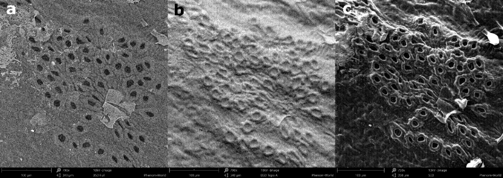 Backscattered electrons và Secondary electrons trong SEM